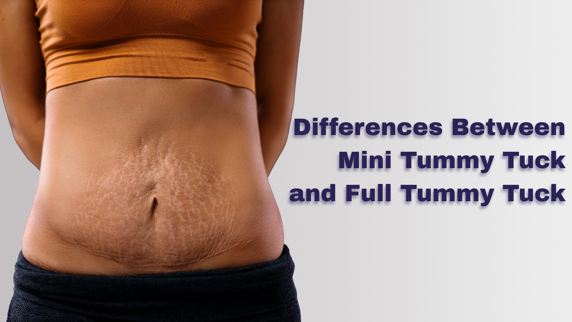 Differences Between Mini Tummy Tuck and Full Tummy Tuck - Sedat Tatar ...